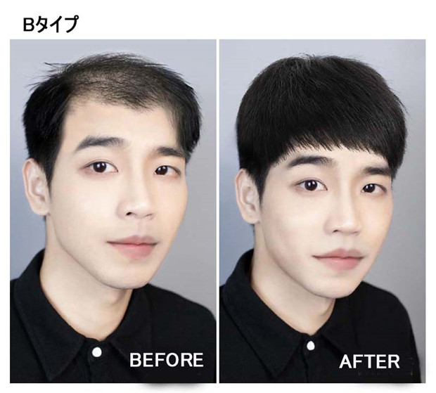 送料無料】部分ウィッグ メンズウィッグ かつら ヘアピース ポイント