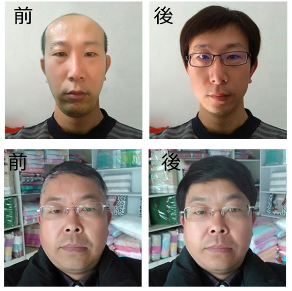 フルウィッグ 人毛かつら 人毛 お父さんウイッグ 普段使い ショット