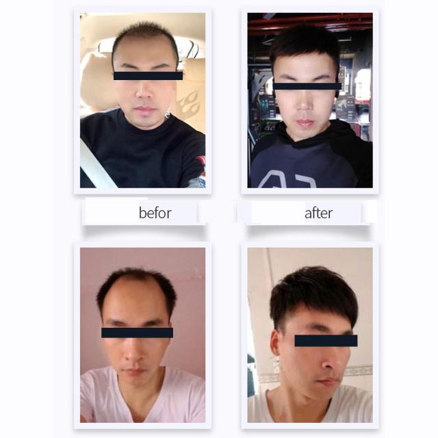 送料無料】総手植えウィッグ メンズウィッグ男性用 耐熱ウィッグ