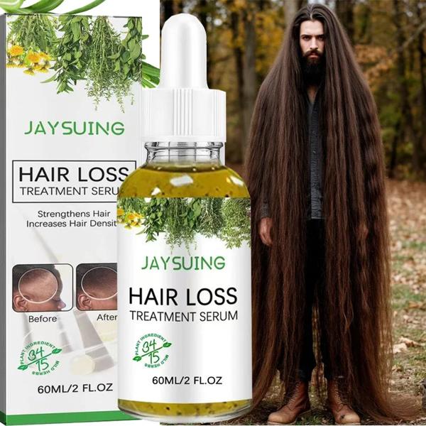 ローズマリーヘアオイル 頭皮用ローズマリーヘアオイル あらゆるタイプと質感の髪に |   ストレート ウェーブ そして化学処理された髪を強化します