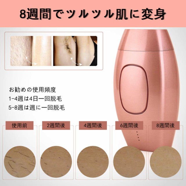 レーザー脱毛器 レディース メンズ 自宅光脱毛器 ipl 60万発 脇毛 処理