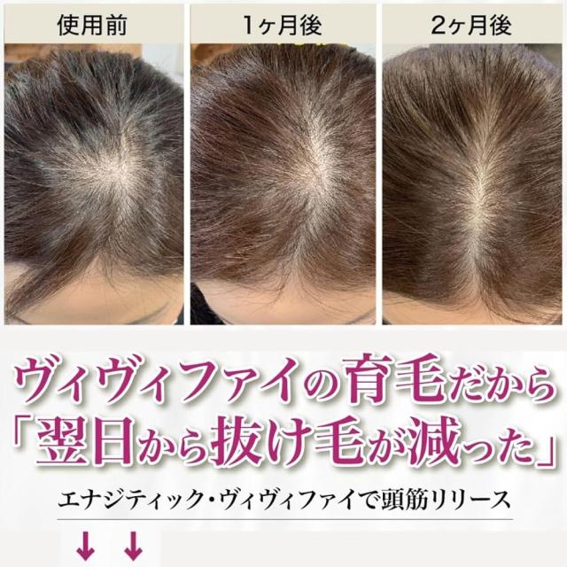 エナジティック・ヴィヴィファイ マッサージローション 育毛ケアの前に