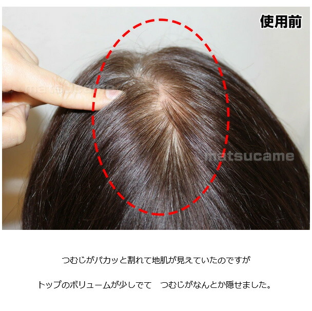 ポイントヘア Lサイズ 部分ウィッグ 分け目 薄毛 白髪隠し ヘア